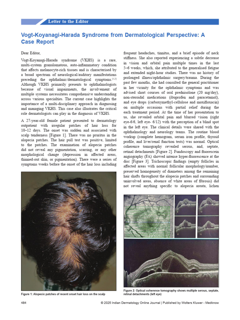Vogt Koyanagi Harada Syndrome From Dermatological.28 | PDF | Medical ...