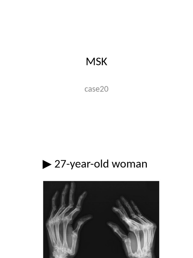 MSK case 20 | PDF