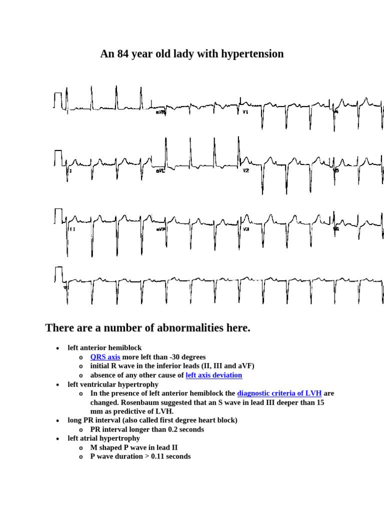 Ecg Questions | PDF | Electrocardiography | Cardiology