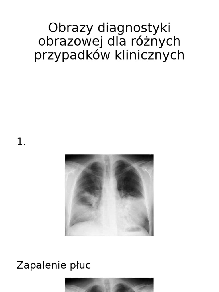 obrazy-praktyczne-do-cz-1 | PDF
