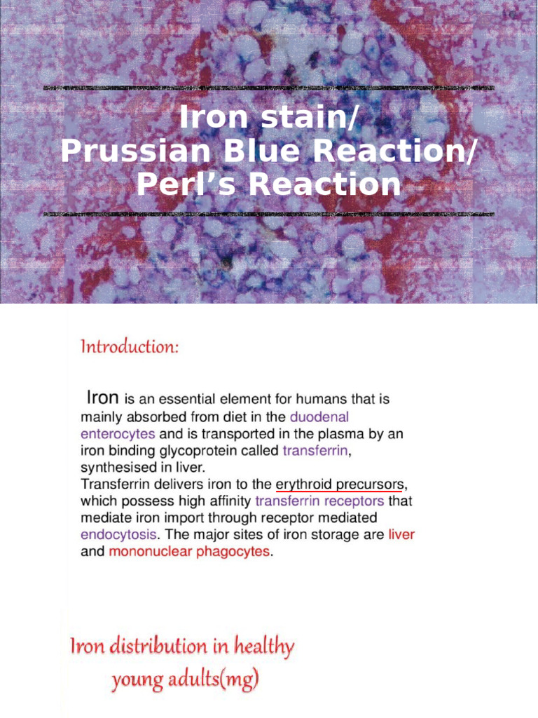Iron Stain and Sideroblast Analysis | PDF