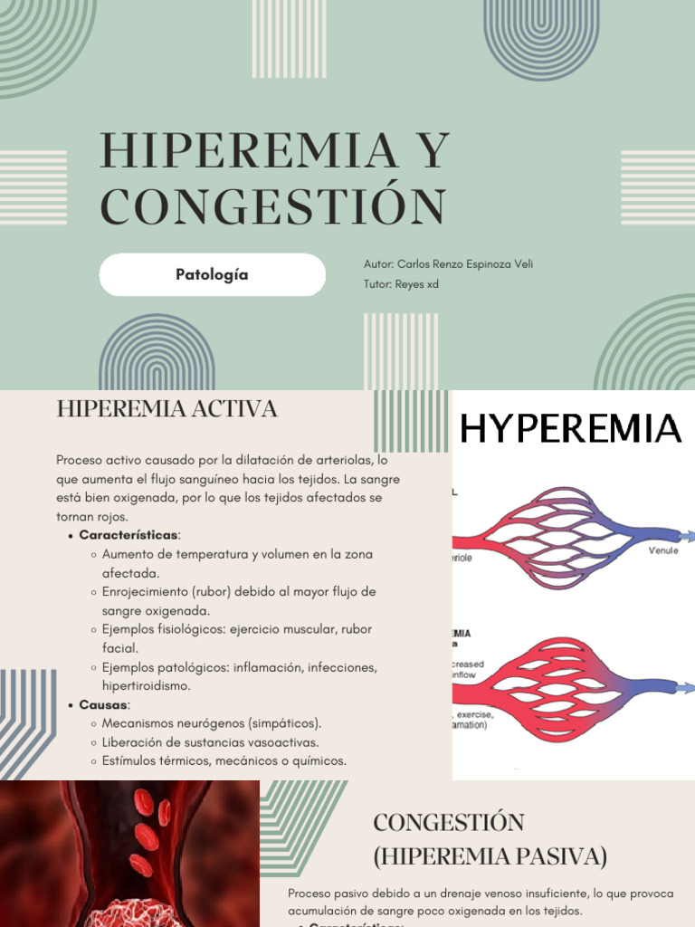 Hiperemia y Congestión: Causas y Efectos | PDF