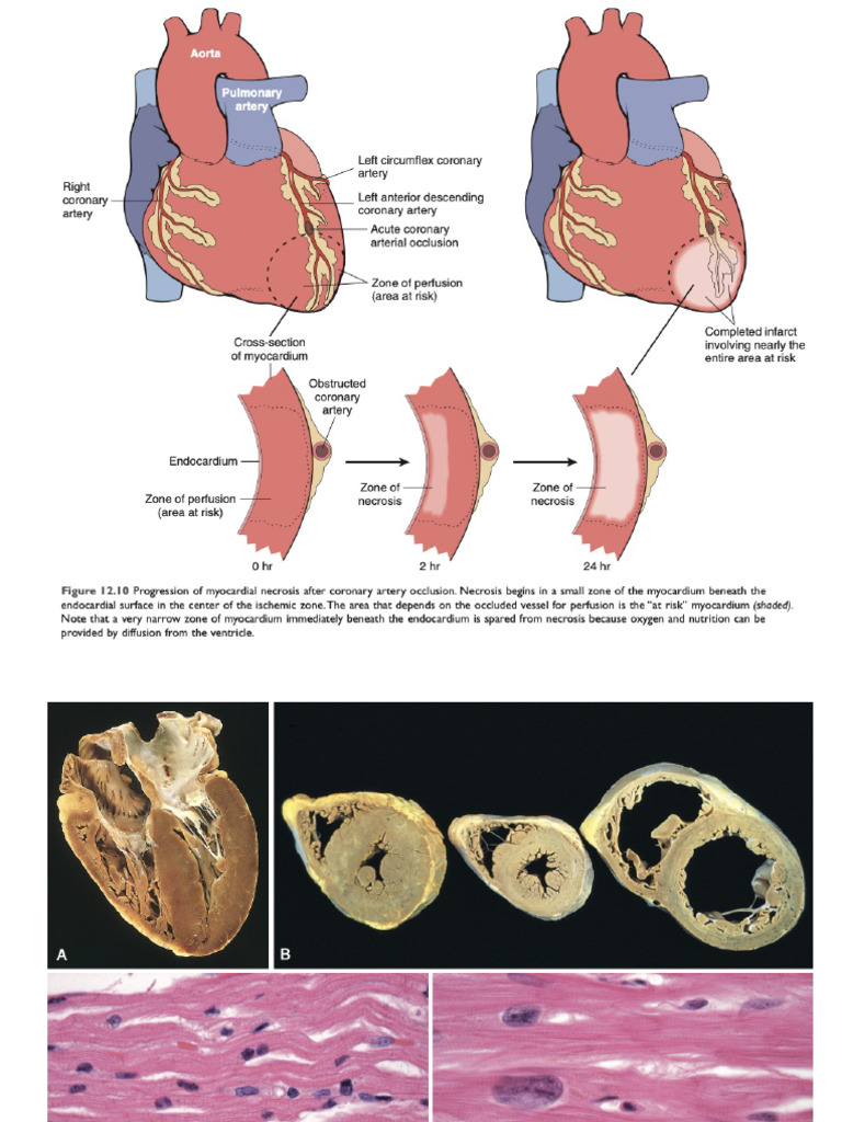 Heart Disorders | PDF
