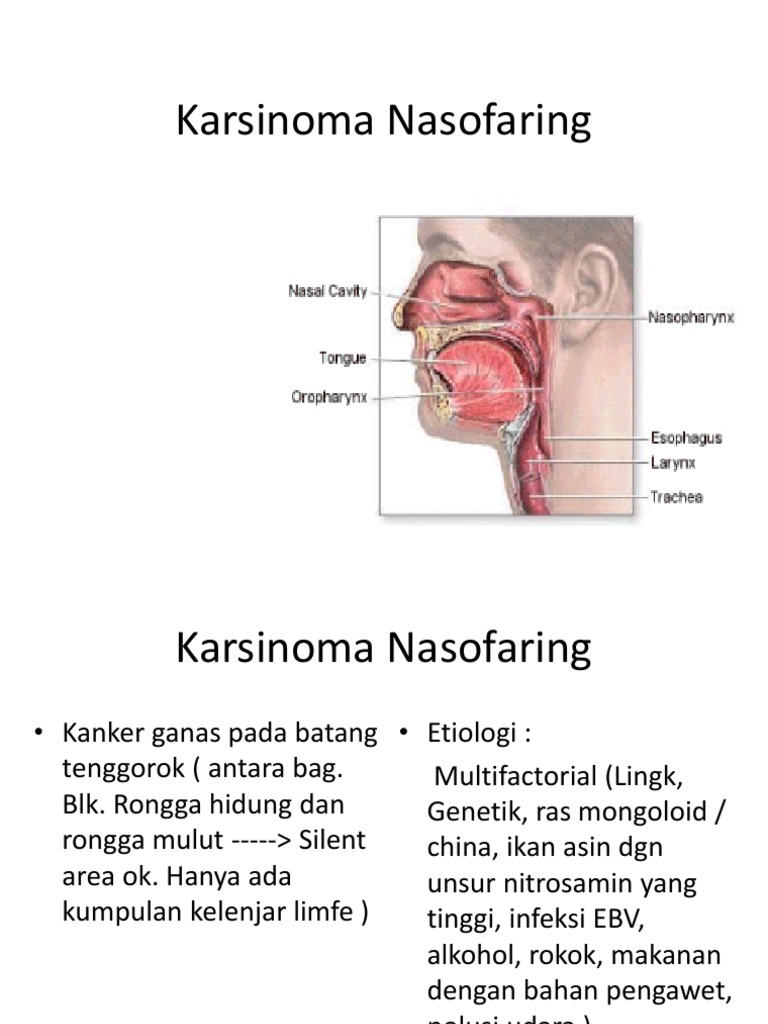 Karsinoma Nasofaring: Gejala dan Pengobatan | PDF