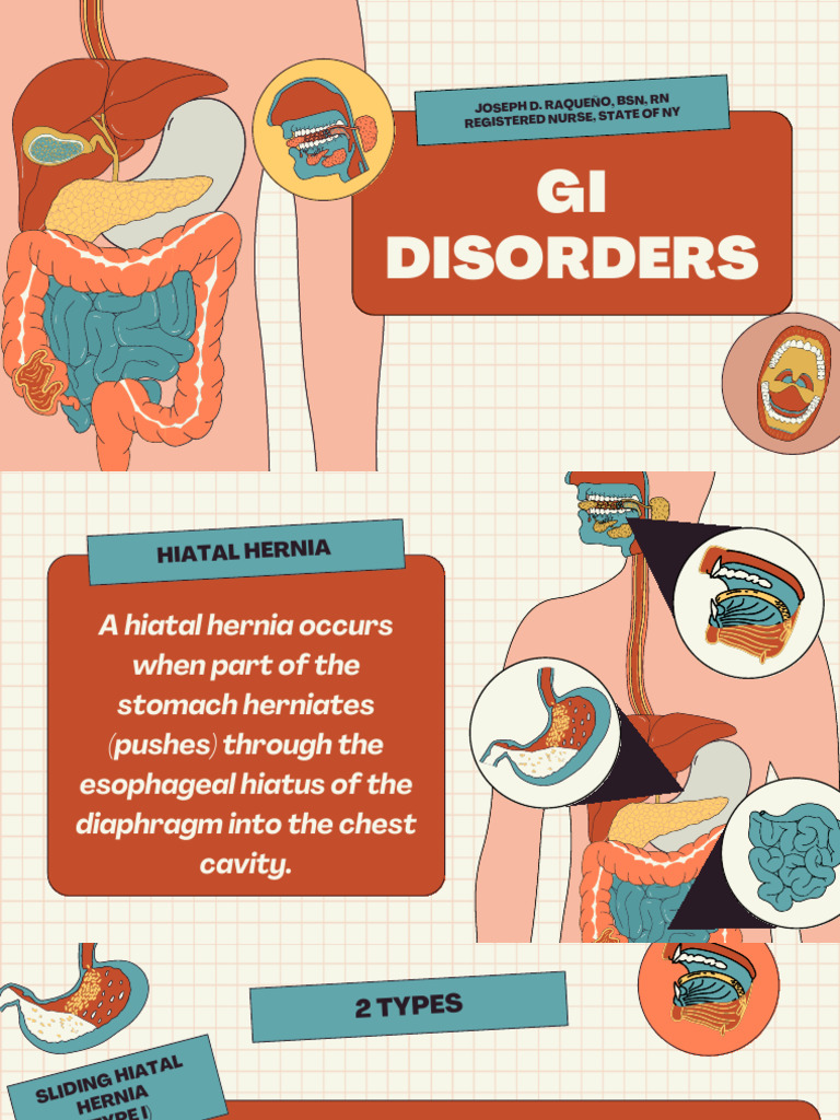 Hiatal Hernia: Types, Symptoms, and Management | PDF | Gastroesophageal ...