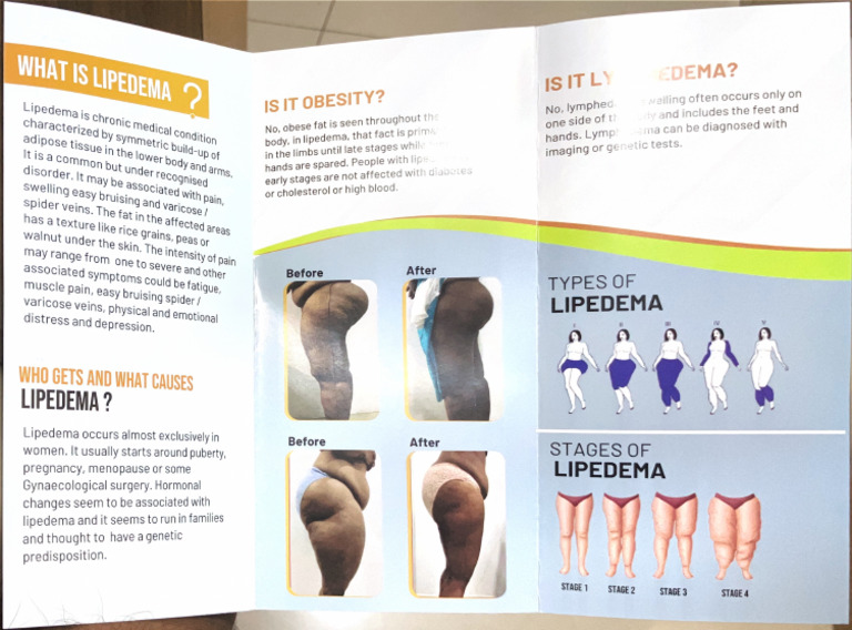 Lip Edema | PDF