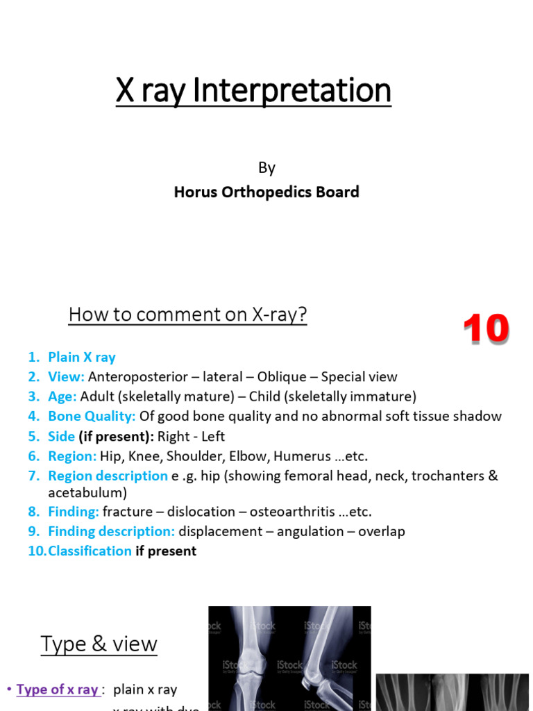 S1 P1 X-Ray Interpretation Upper Limb (2) | PDF | Hip | Limbs (Anatomy)