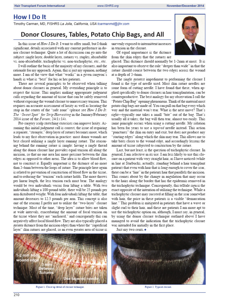 Hair Donor Closures | PDF | Surgical Suture | Surgery