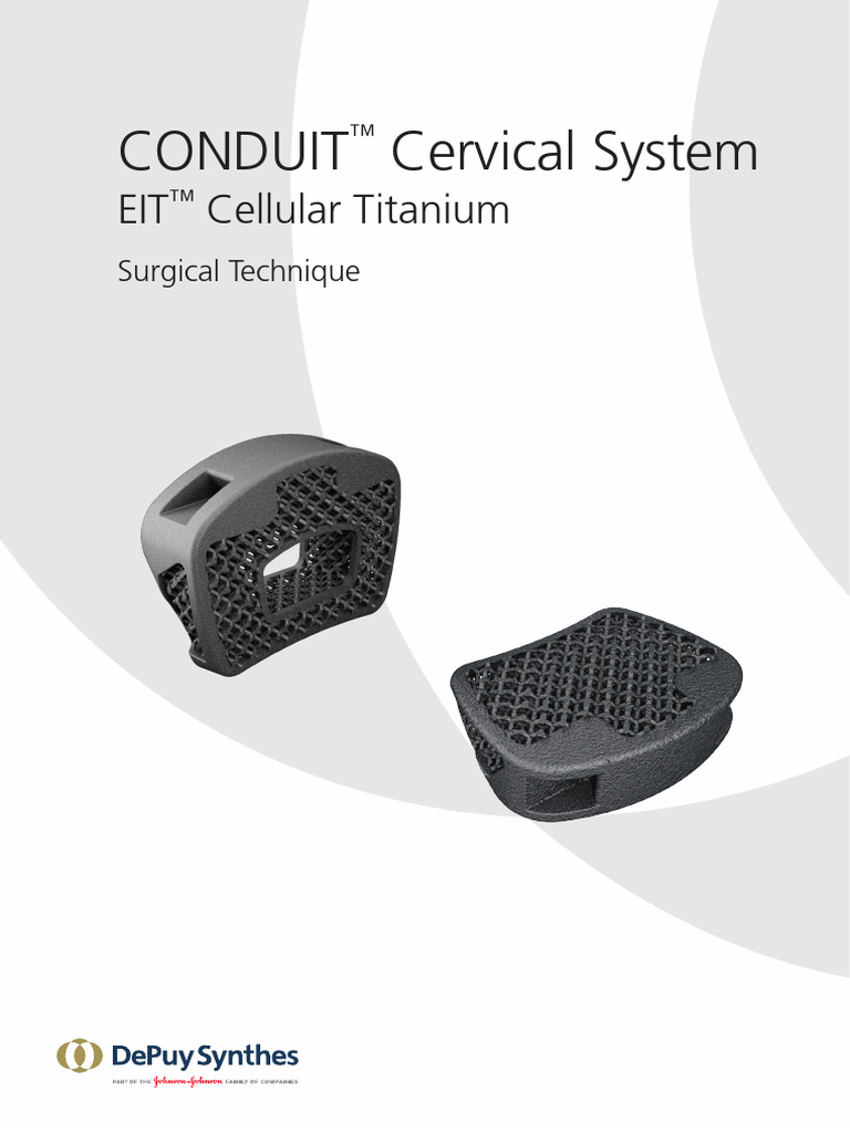 CONDUIT Cervical System Surgical Guide | PDF | Vertebra | Implant ...