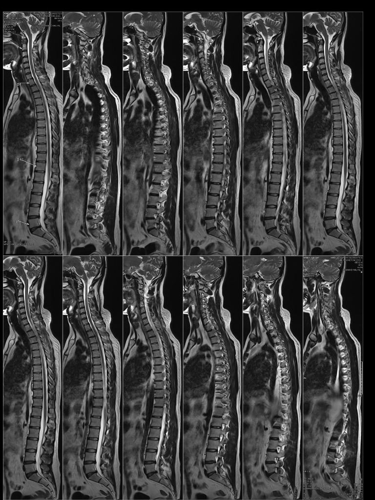 Spine | PDF