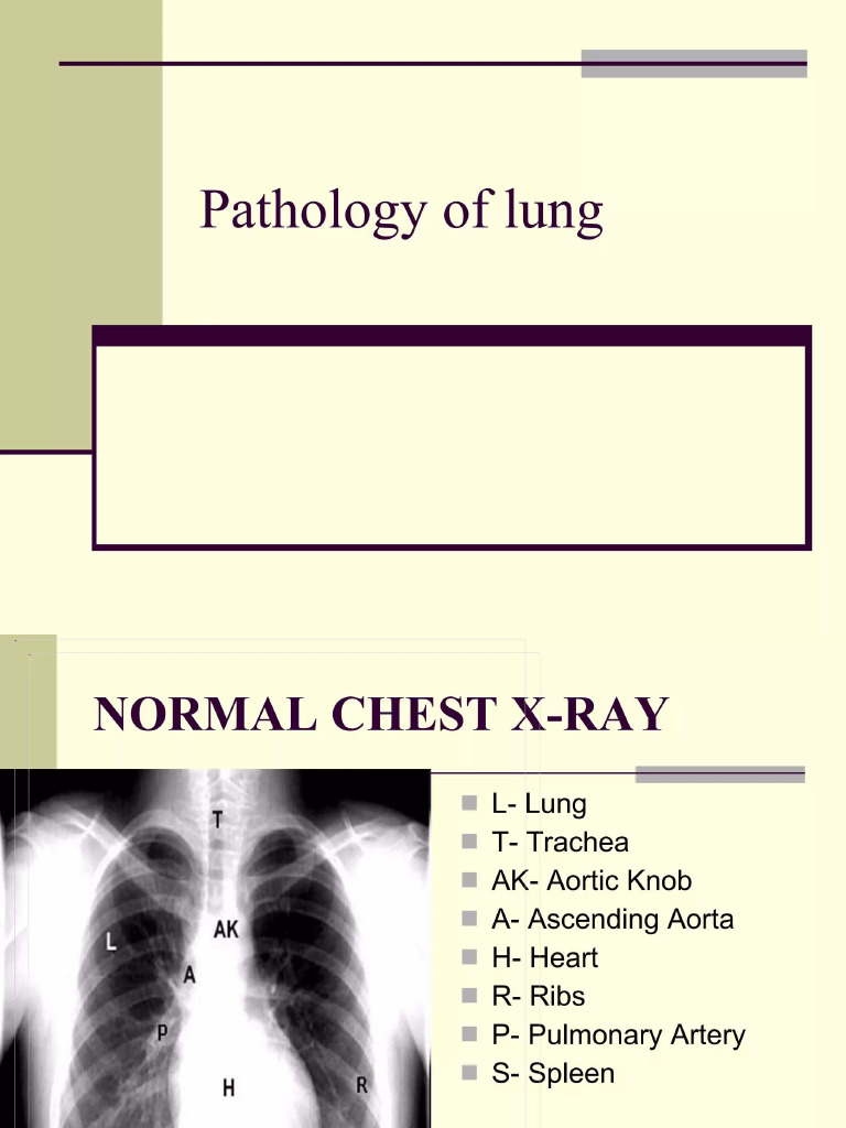 Lung Pathologies | PDF