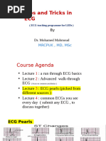 Understanding Wellens Syndrome ECG Patterns | PDF | Electrocardiography ...