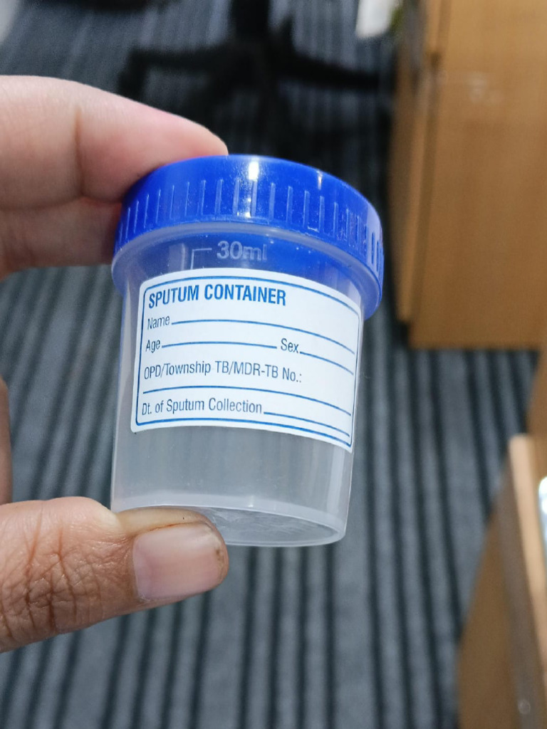 Sputum Collection Container 30 ML | PDF