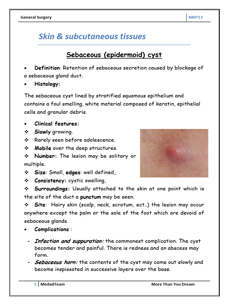 General Surgery MedadTeam [SUR-423] | PDF | Chess | Chess Theory