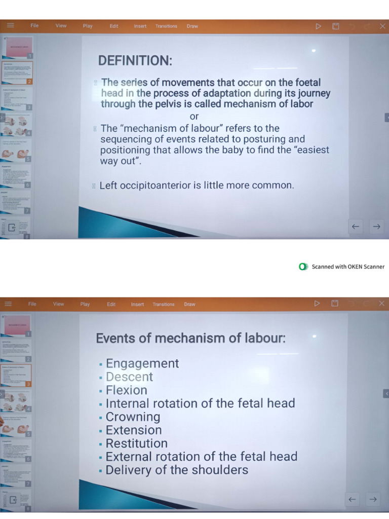 Mechanisms of Normal Labour | PDF