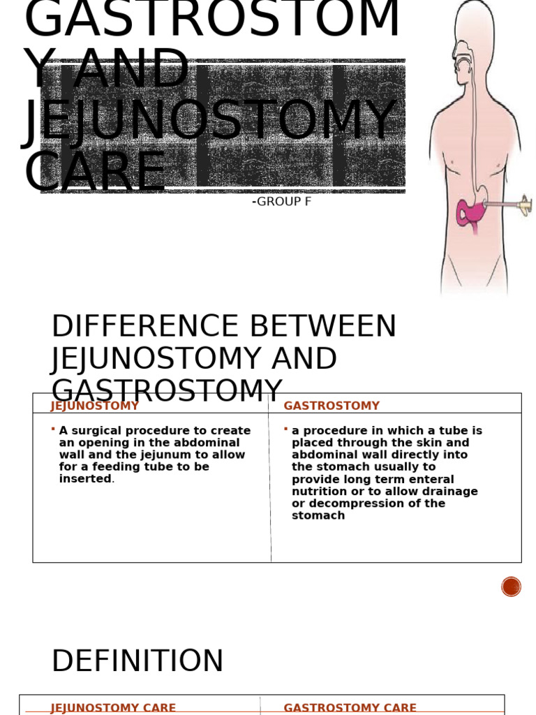 Gastro-Jejunostomy Final | PDF | Esophagus | Medical Specialties