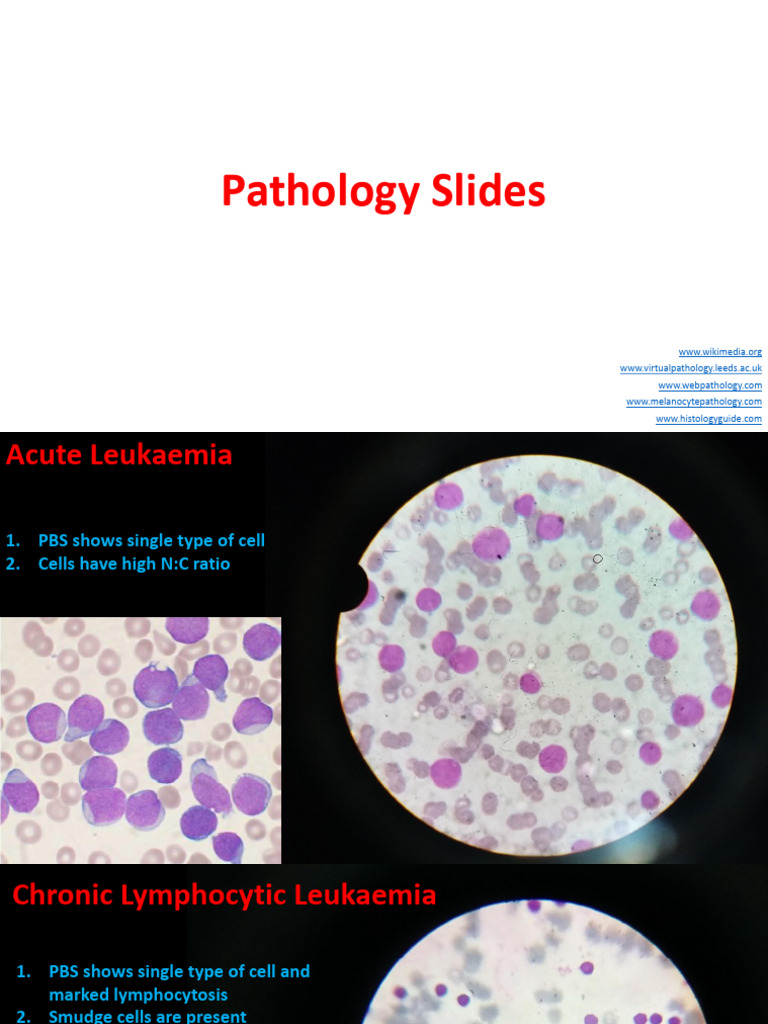 Patho Slide 1 | PDF