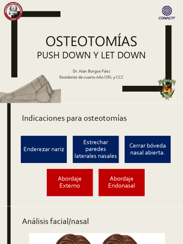 Osteotomias Push Down Ylet Down | PDF | Nariz humana | Anatomía humana