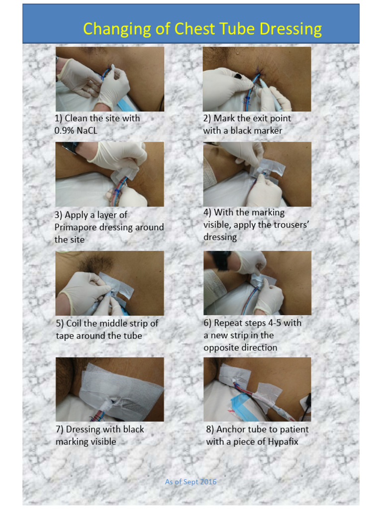 SICU Chest Tube Dressing (Sep 2016) | PDF