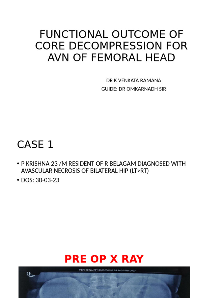 Core Decompression Outcomes for AVN | PDF