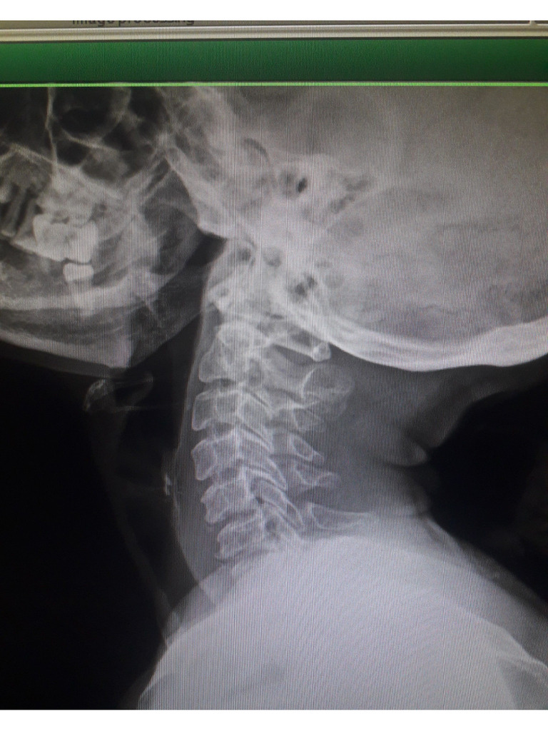General Position of X Rays | PDF