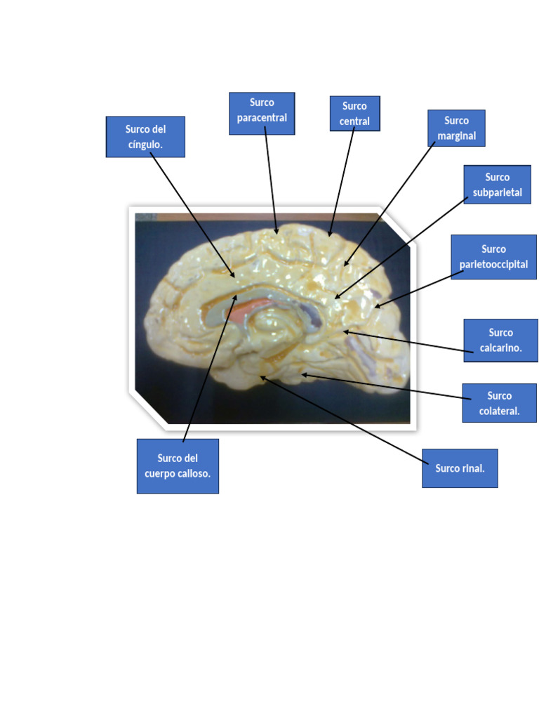 Brain Sulci Overview and Types | PDF