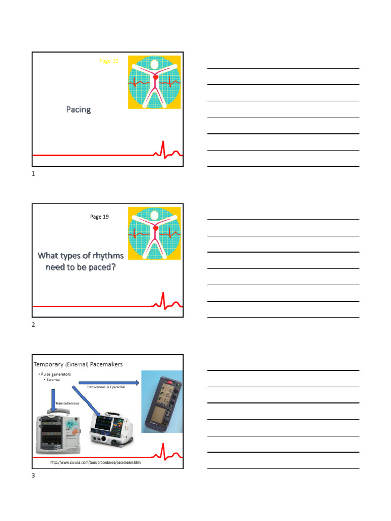 5. Alt in Circulation Pacing 2021 - Plain | PDF | Clinical Medicine ...