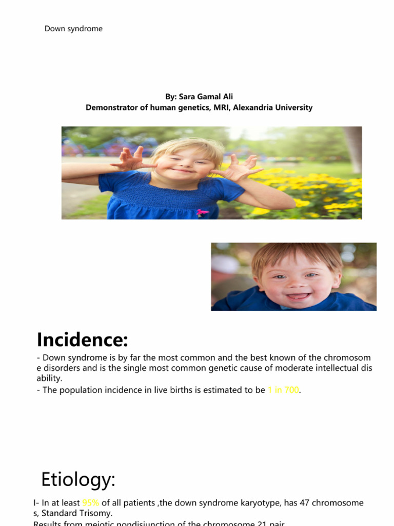Down Syndrome | PDF