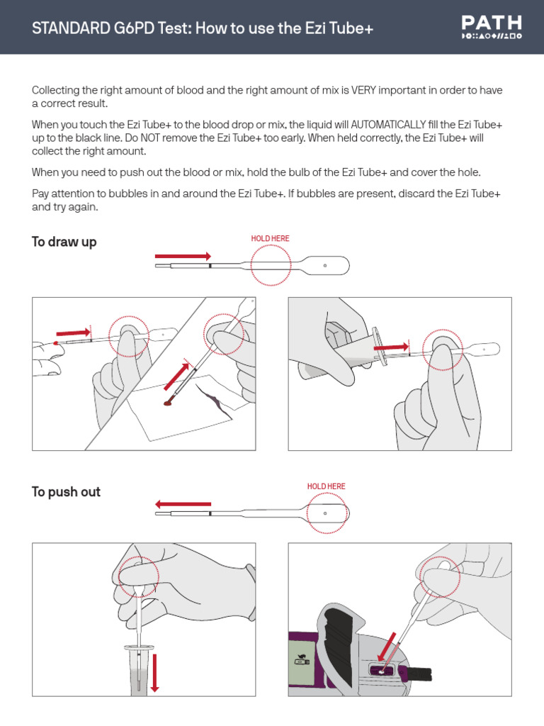 G6PD EZI Tube How to Feb2021 | PDF