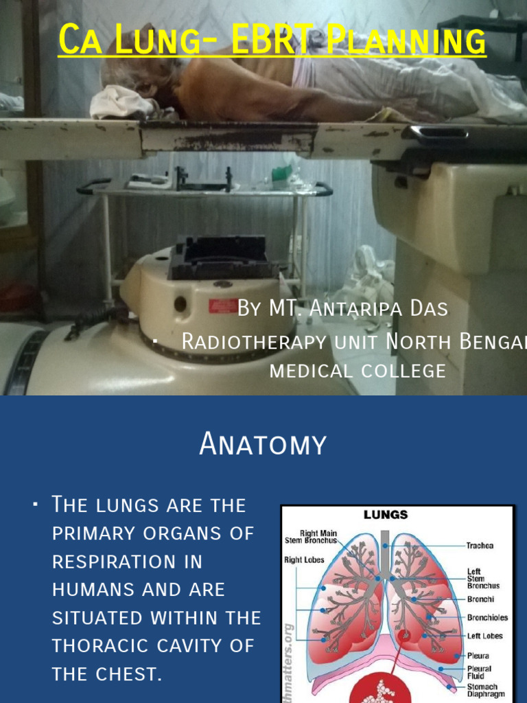 By Antaripa Das | PDF | Lung Cancer | Radiation Therapy