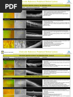 Understanding White Without Pressure (WWOP) | PDF | Vision | Ophthalmology