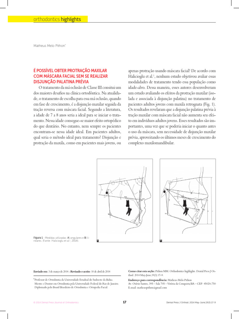 -É possível obter protração maxilar com máscara facial sem se realizar ...