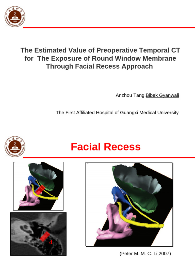 1the Estimated Value of Preoperative Temporal CT For Visibility of ...