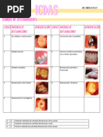 Clasificación y Códigos ICDAS en Odontología | PDF | Esmalte de dientes ...