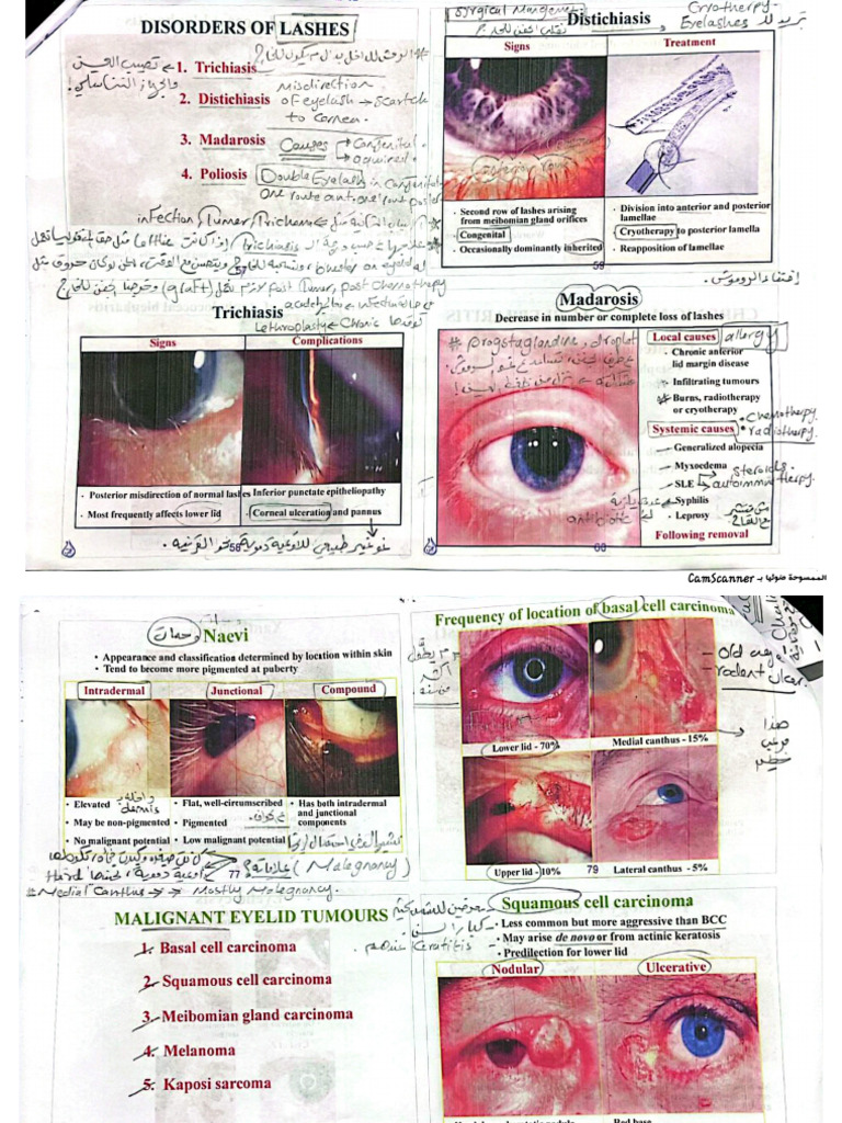 Fourth Lecture Clinical Ophthalmology | PDF