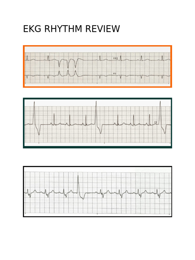 EKG Strips Student Practice | PDF