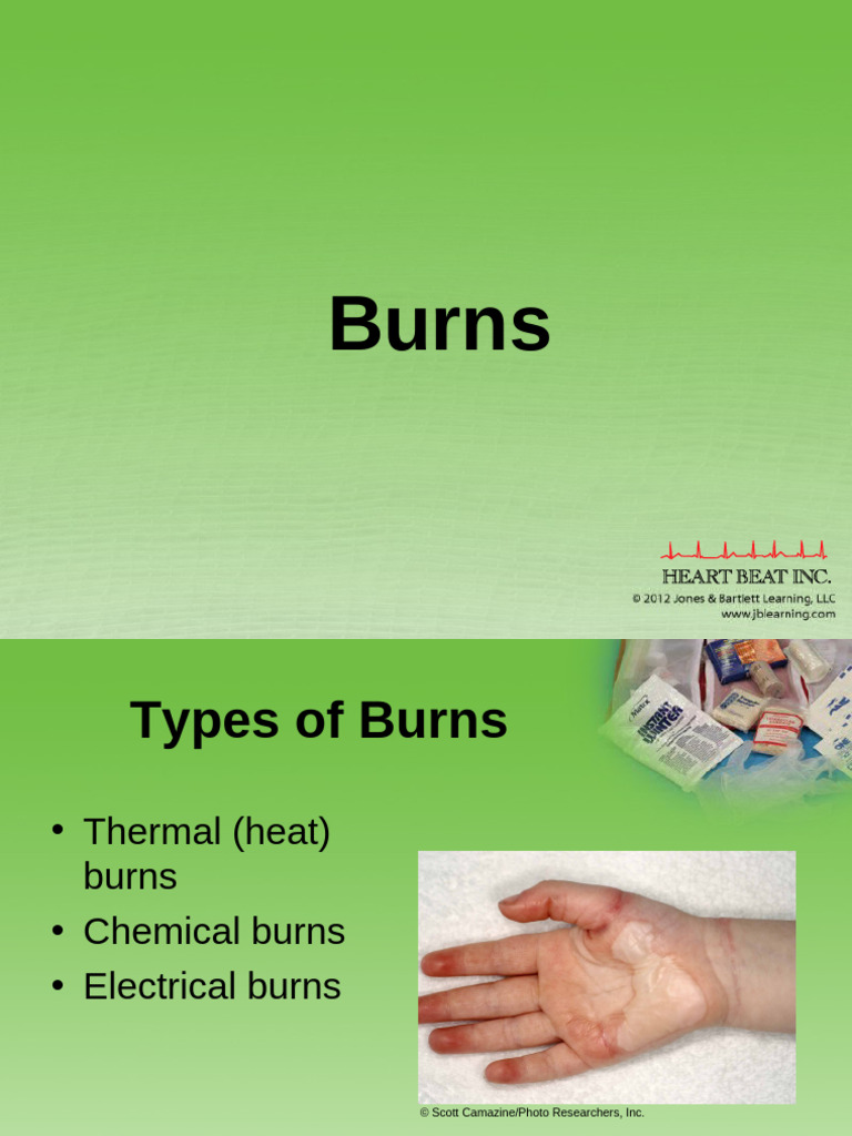 Comprehensive Guide to Burn Types and Care | PDF