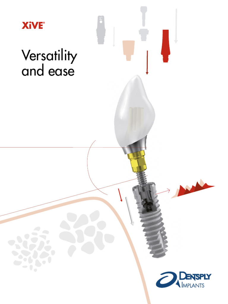 System Brochure XiVE - Dentsply Implant System | PDF | Dental Implant ...