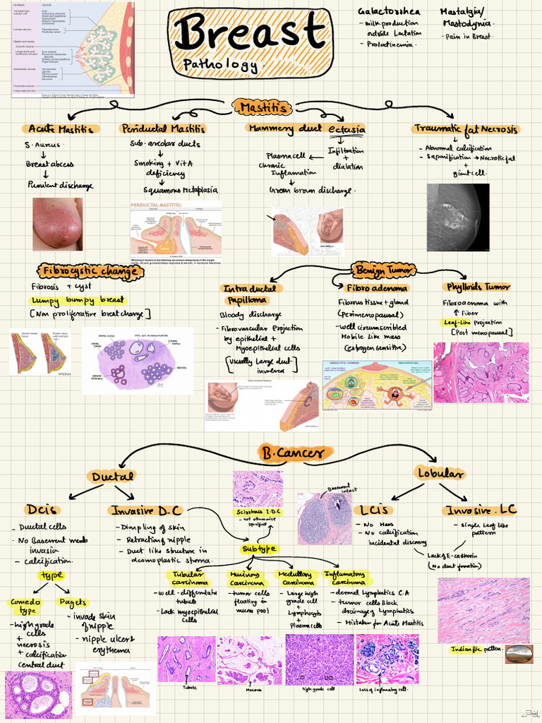 Breast Pathology @CEREBELLUMBTR2pdfs | PDF