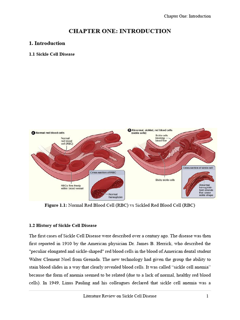 Sickle Cell Disease | PDF | Hematopoietic Stem Cell Transplantation ...