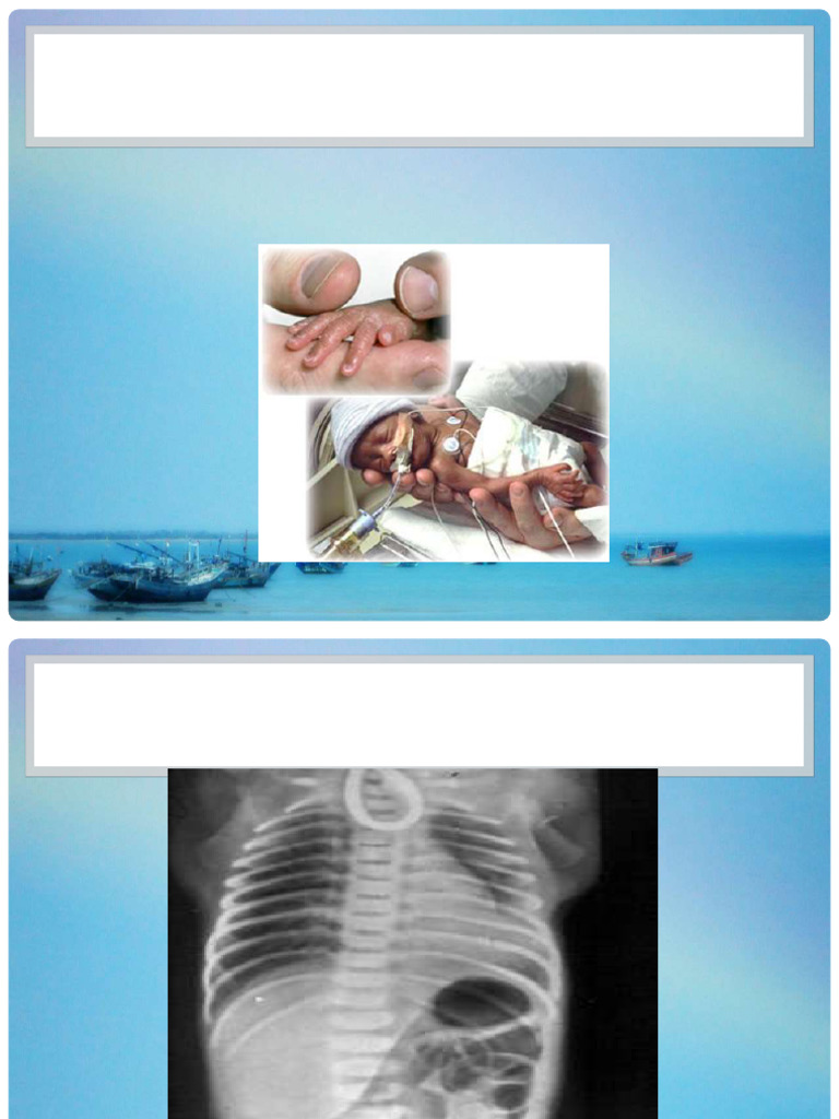 tof ppt | PDF | Esophagus | Anatomy