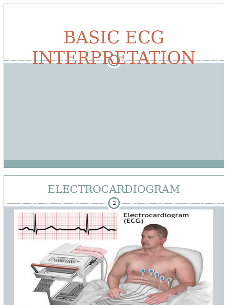 Basic ECG Interpretation Guide | PDF | Electrocardiography | Internal ...