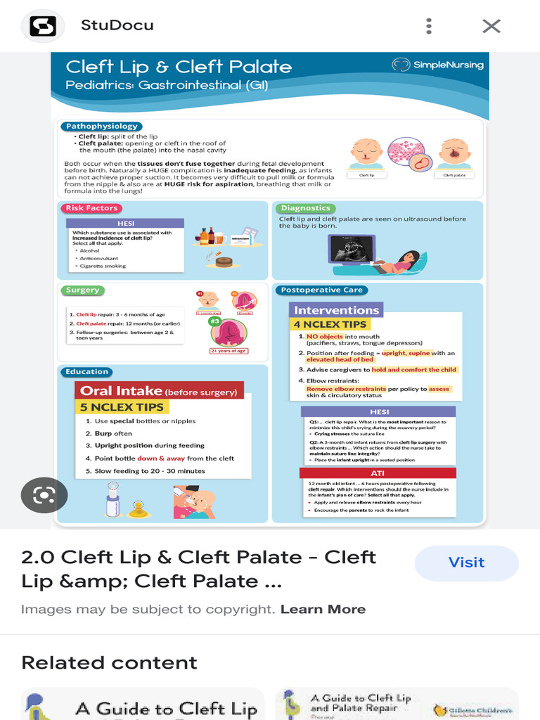 Cleft Lip and Palate Care Guide | PDF | Chess Theory | Chess