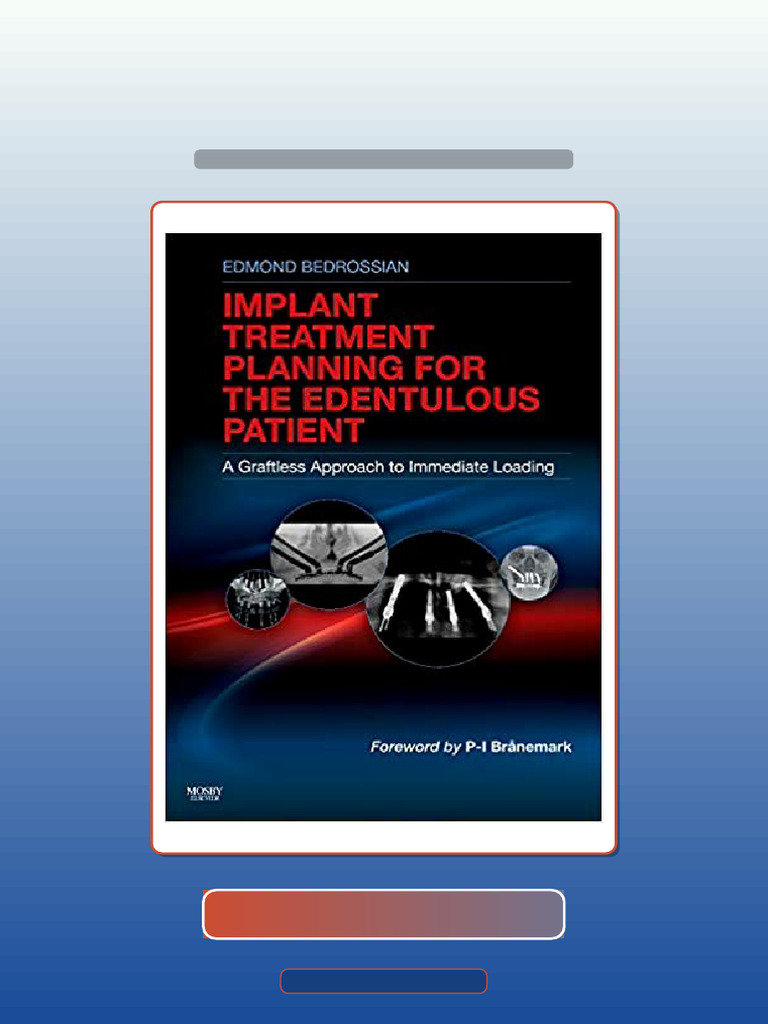 Test Bank for Implant Treatment Planning for the Edentulous Patient by ...