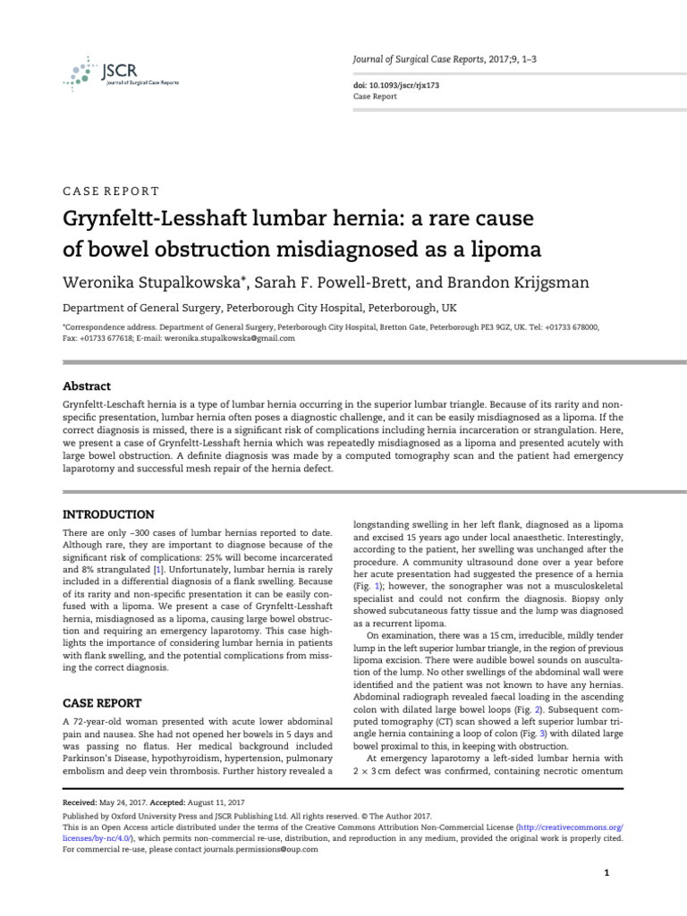 Grynfeltt-Lesshaft Lumbar Hernia a Rare Cause of b | PDF | Large ...