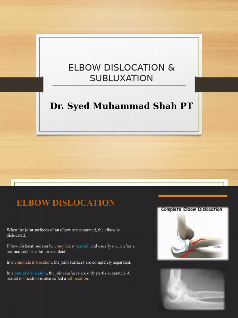Elbow Dislocation | PDF
