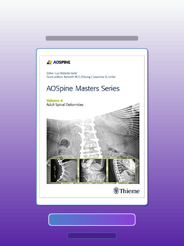 AOSpine Masters Series Volume 4 Adult Spinal Deformities by Lawrence G ...