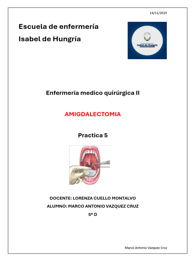 Amigdalectomia MA | PDF
