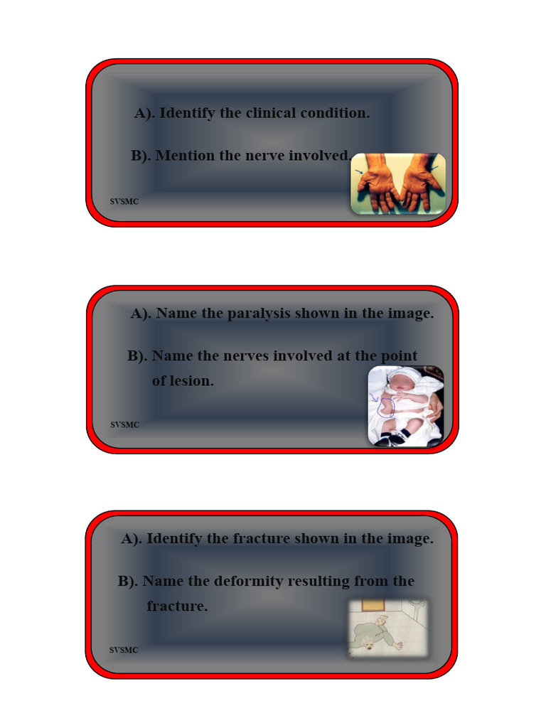 OSPE Charts | PDF | Human Anatomy | Diseases And Disorders