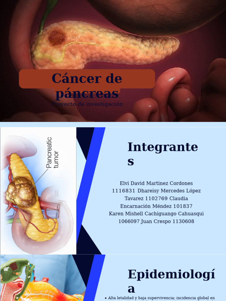 Ca. Pancreas | PDF | Especialidades Medicas | Páncreas